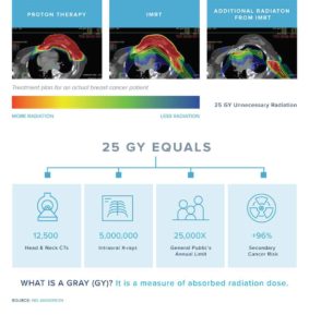 Proton Therapy - Oklahoma Cancer Center